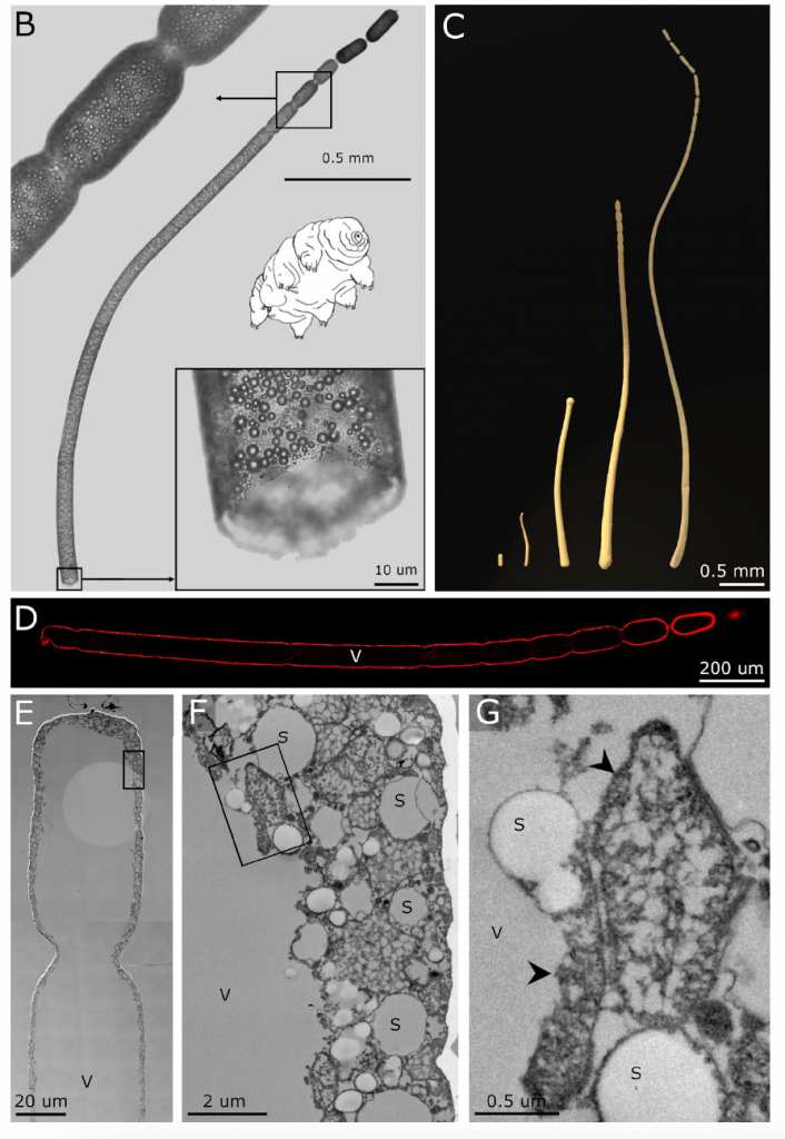 La magnífica Thiomargarita: la bacteria más grande jamás descrita ...